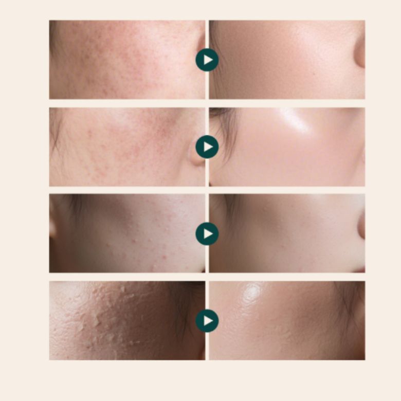 REJUALL Advanced PDRN Repair Cream 20g Best Price and Fast Shipping ...